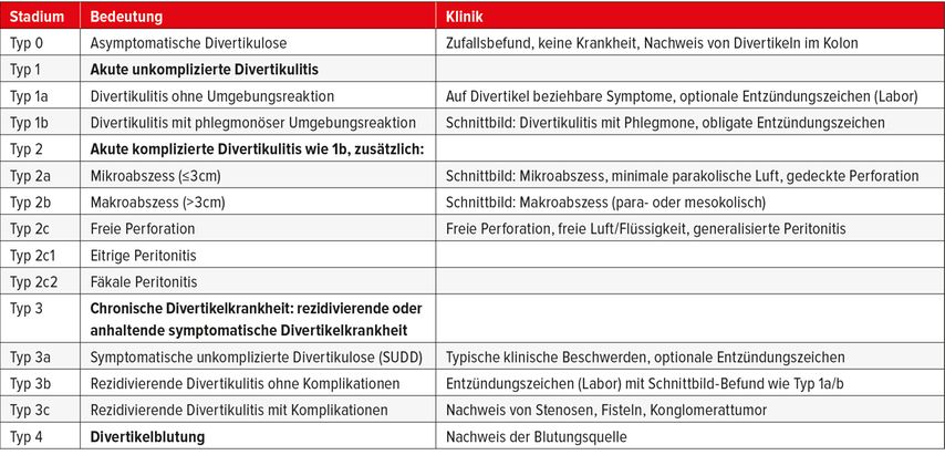 Behandlung der Sigmadivertikulitis – aktualisierte Leitlinien - Gastroenterologie - Universimed ...